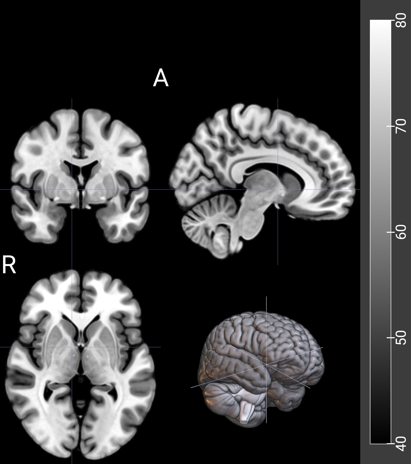 Detecting ADHD through fMRI signals using ML classification models